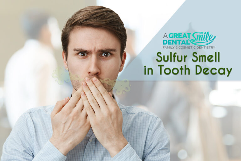 Sulfur Smell in Tooth Decay